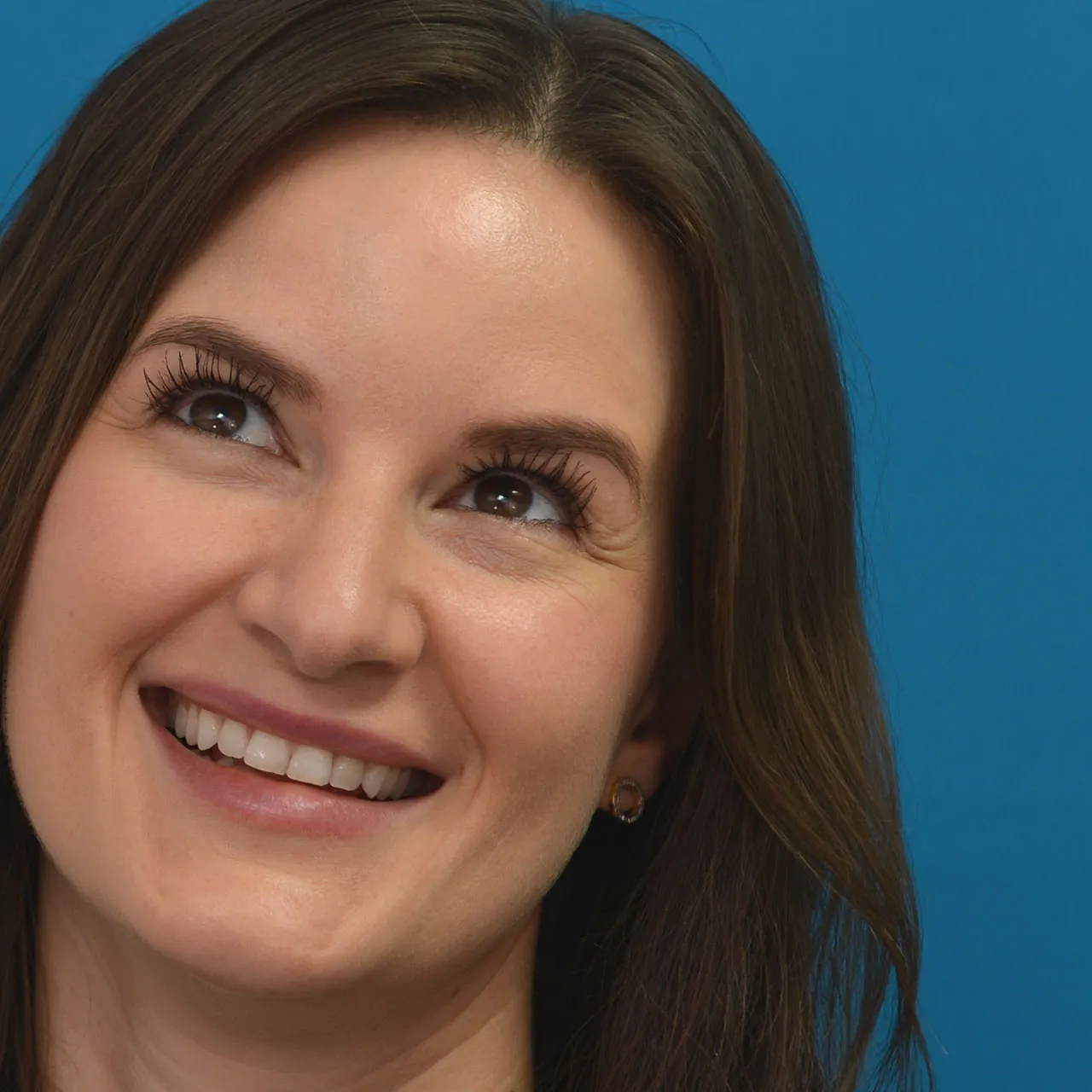 Dentalästhetik - Zahnarztpraxis Dr. Rieß: Ihr Zahnarzt für Wittlich ...